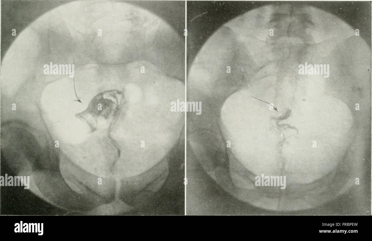 A 1906 journal focused on advancements in radiology, radium therapy ...