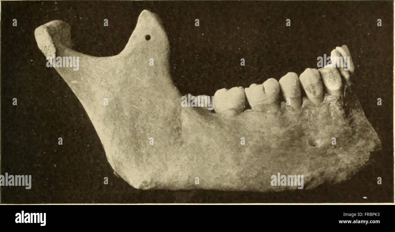 Oral Roentgenology - a Roentgen study of the anatomy and pathology of ...