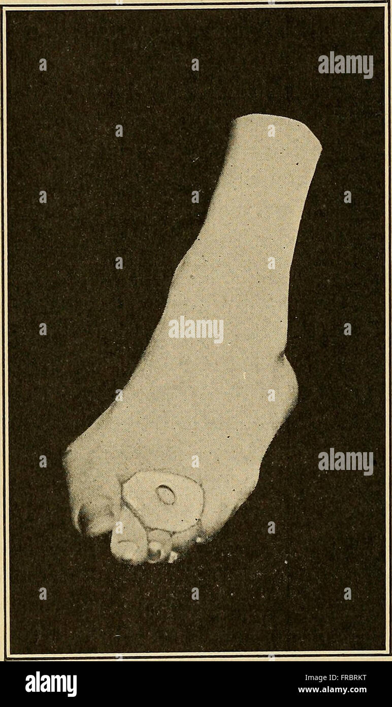 A 1918 guide focused on podiatry, providing practical information for ...