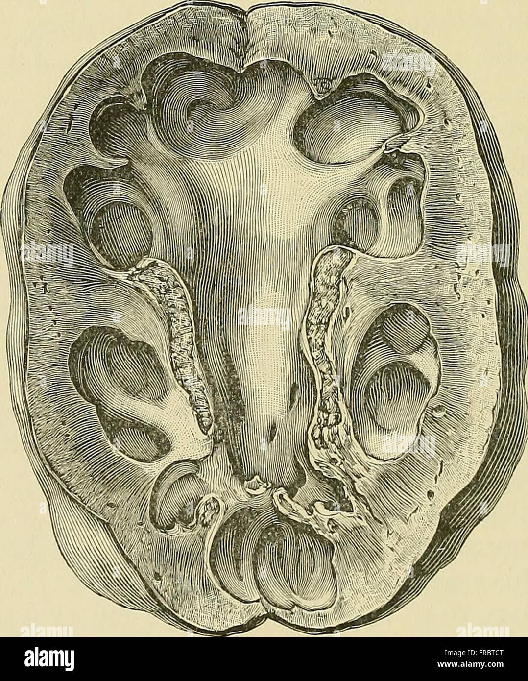 This work discusses the history and advancement of renal surgery ...