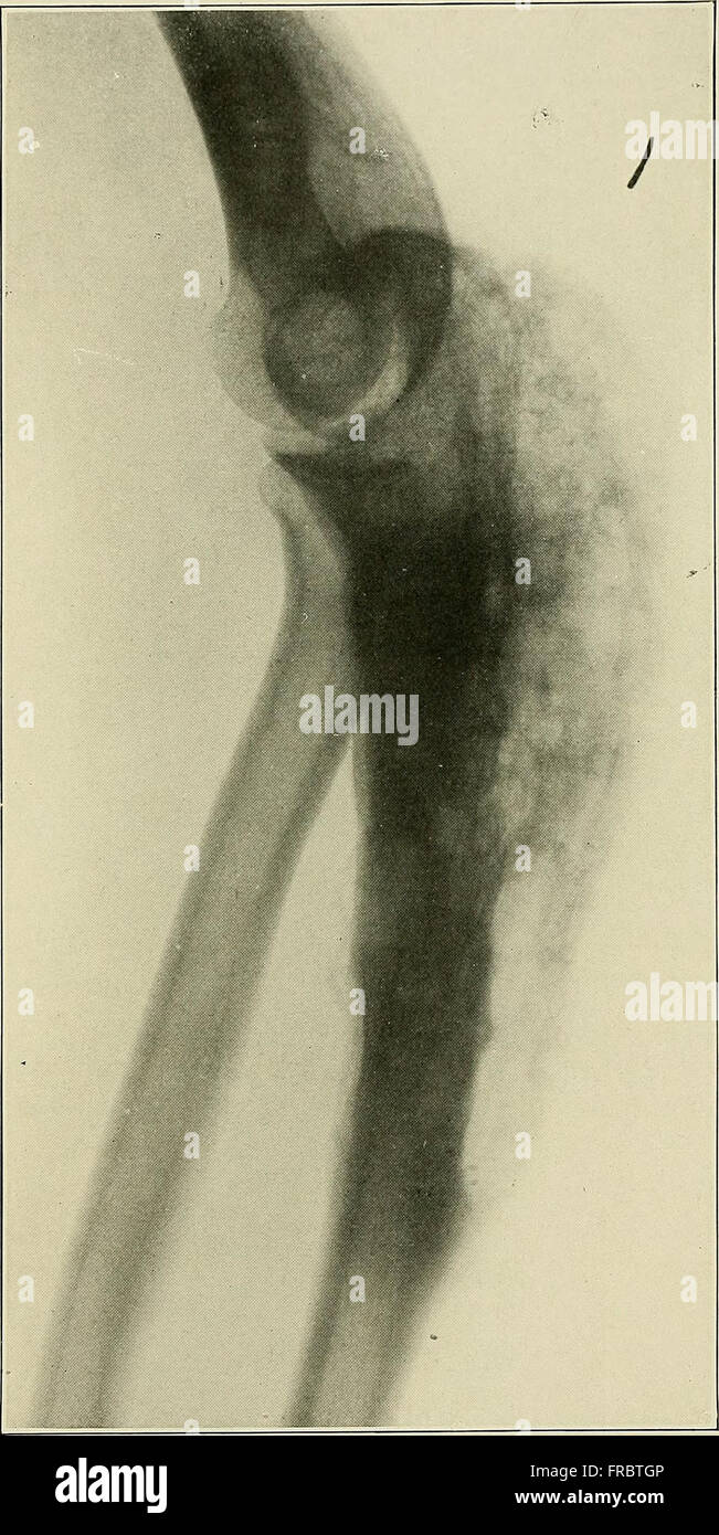 This 1921 work on syphilis provides a comprehensive study of the ...