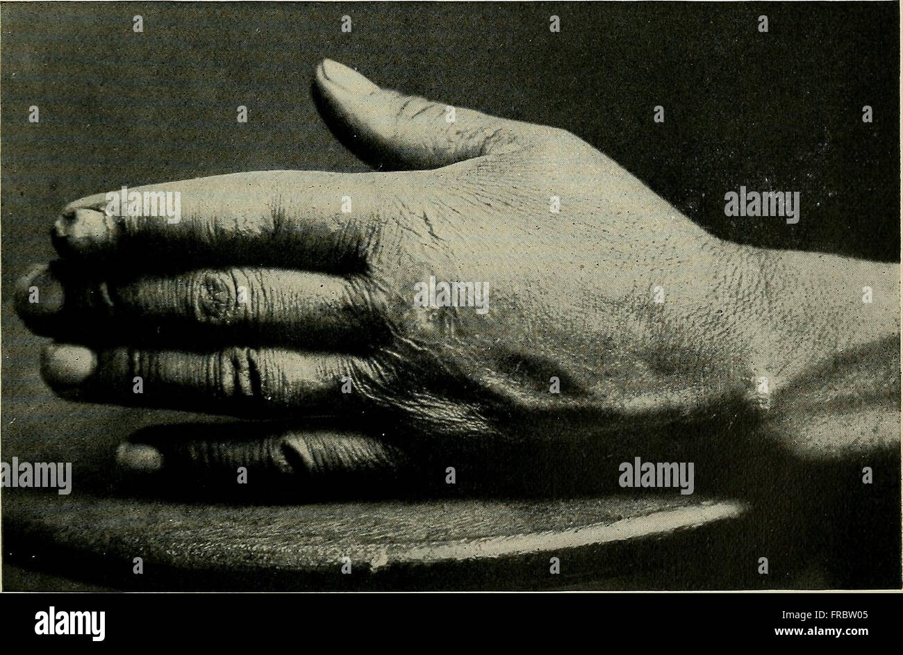 Radiotherapy and phototherapy - including radium and high-frequency ...