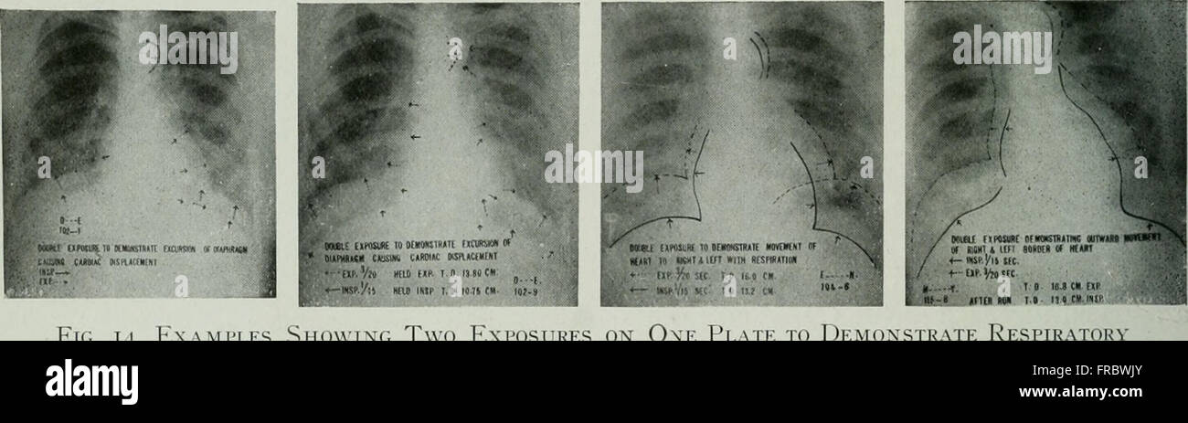 'The American Journal of Roentgenology, Radium Therapy and Nuclear ...