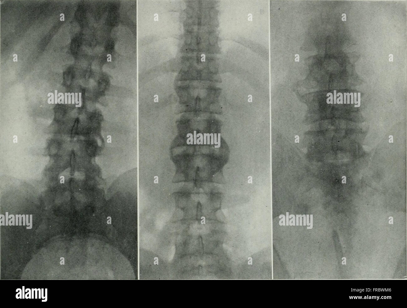 A 1906 journal exploring advancements in roentgenology, radium therapy ...