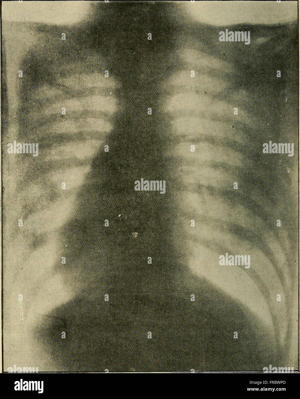 Published in 1907, this work explores the use of Roentgen rays (X-rays ...