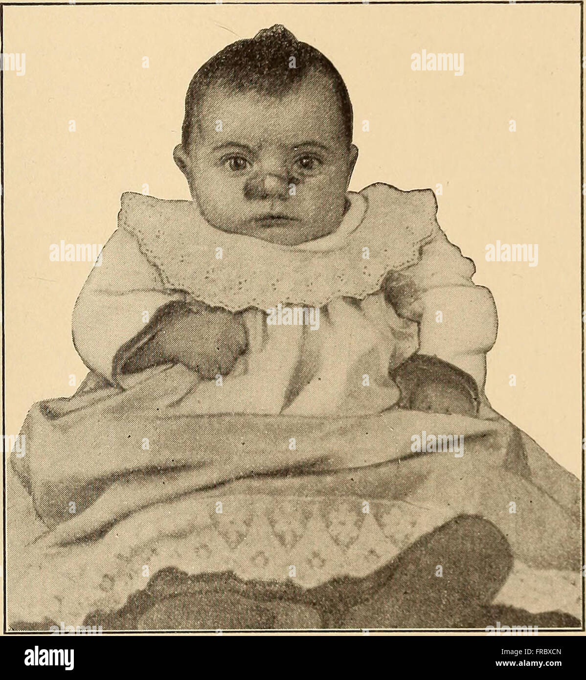 This book provides an overview of common diseases in infancy and ...