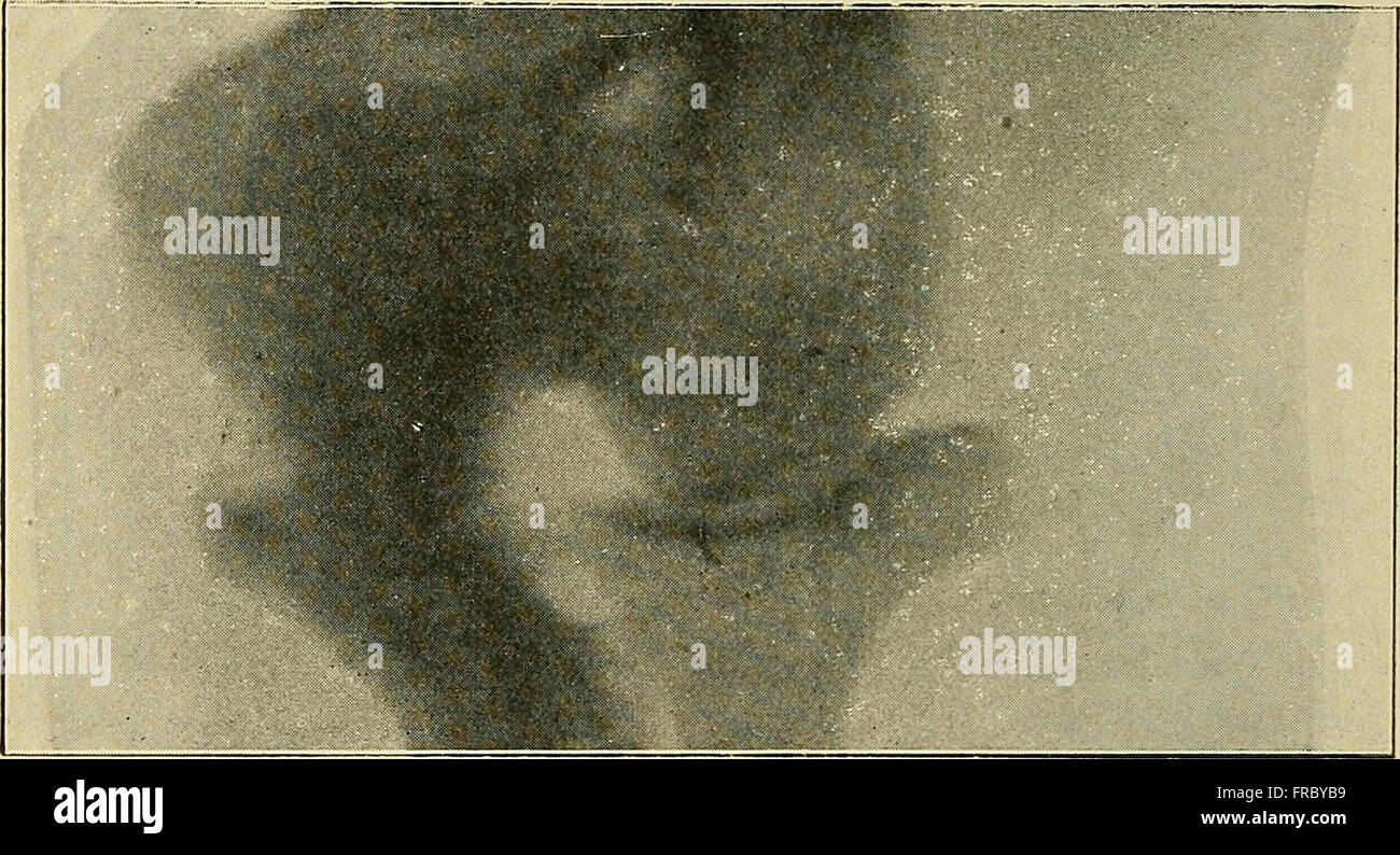 This 1907 publication explores the application of X-rays (Roentgen rays ...