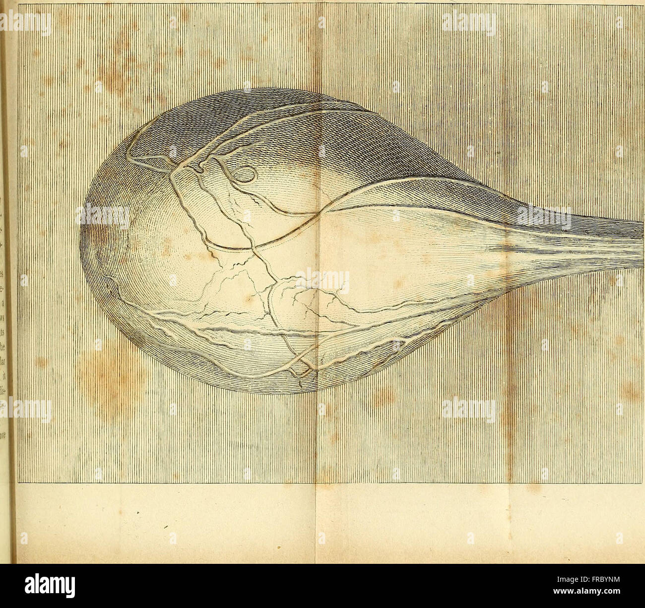 The chirurgical works of Percivall Pott (1808 Stock Photo - Alamy