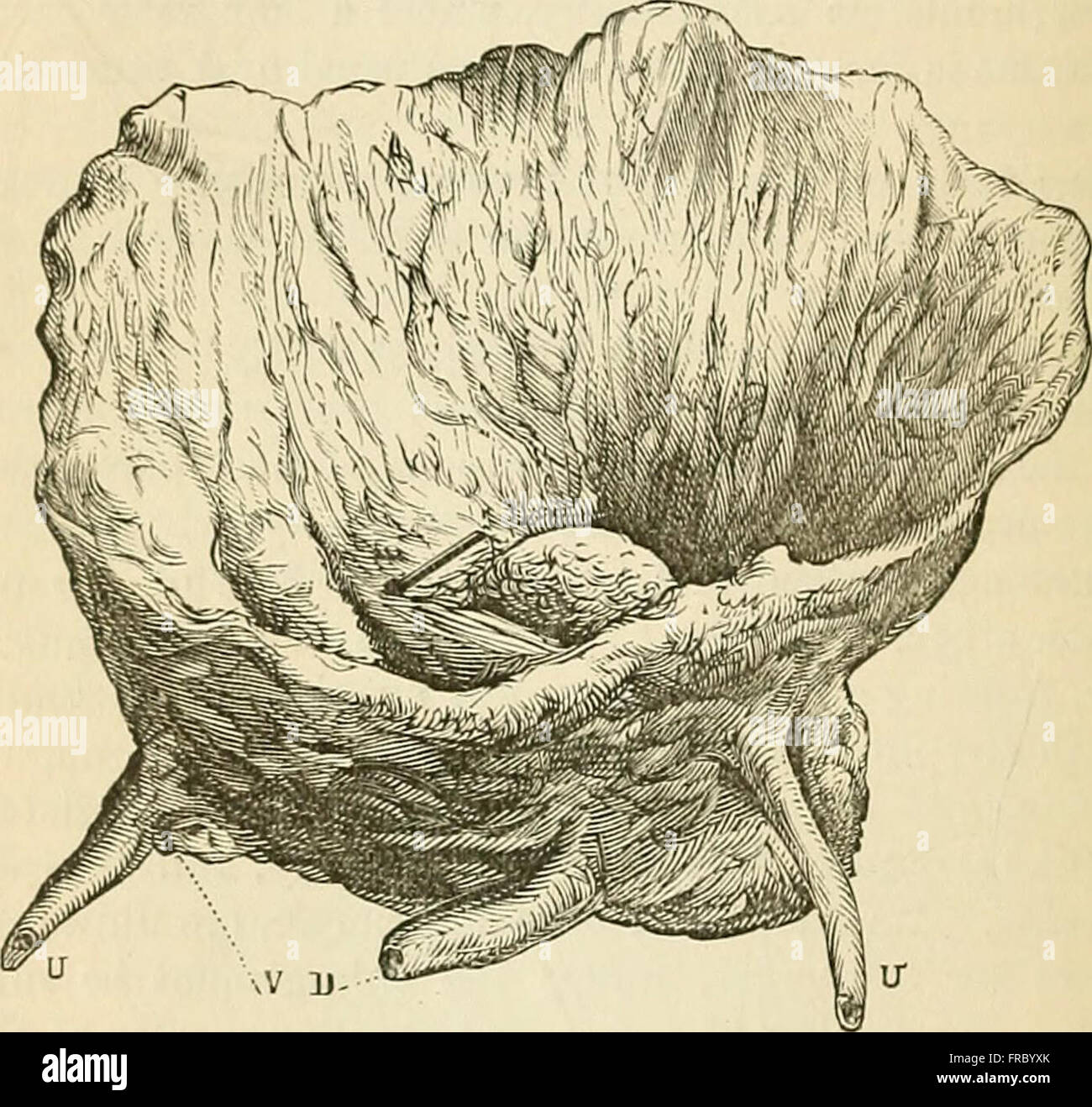 Genito urinary organs hi-res stock photography and images - Alamy