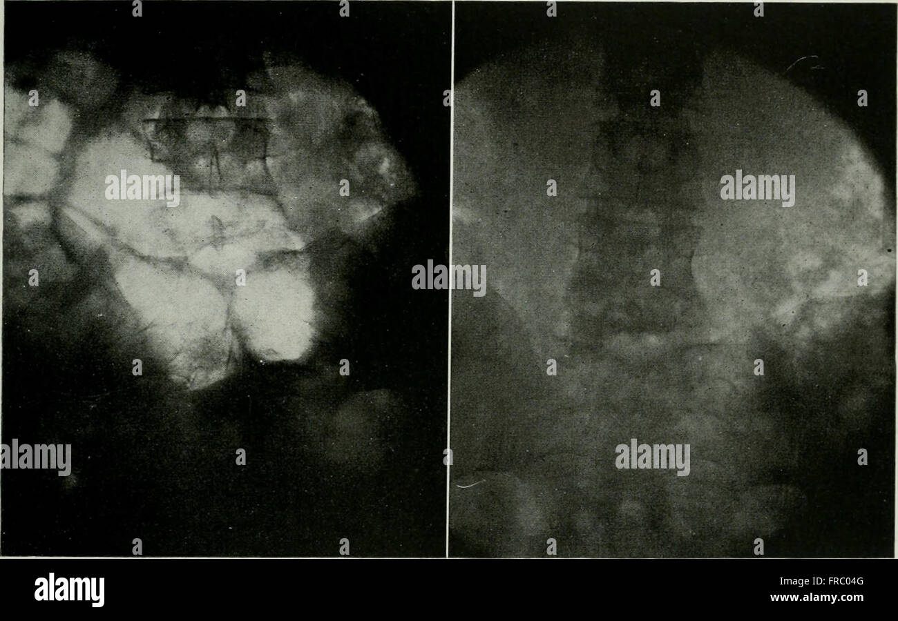 The 1906 edition of The American Journal of Roentgenology, Radium ...