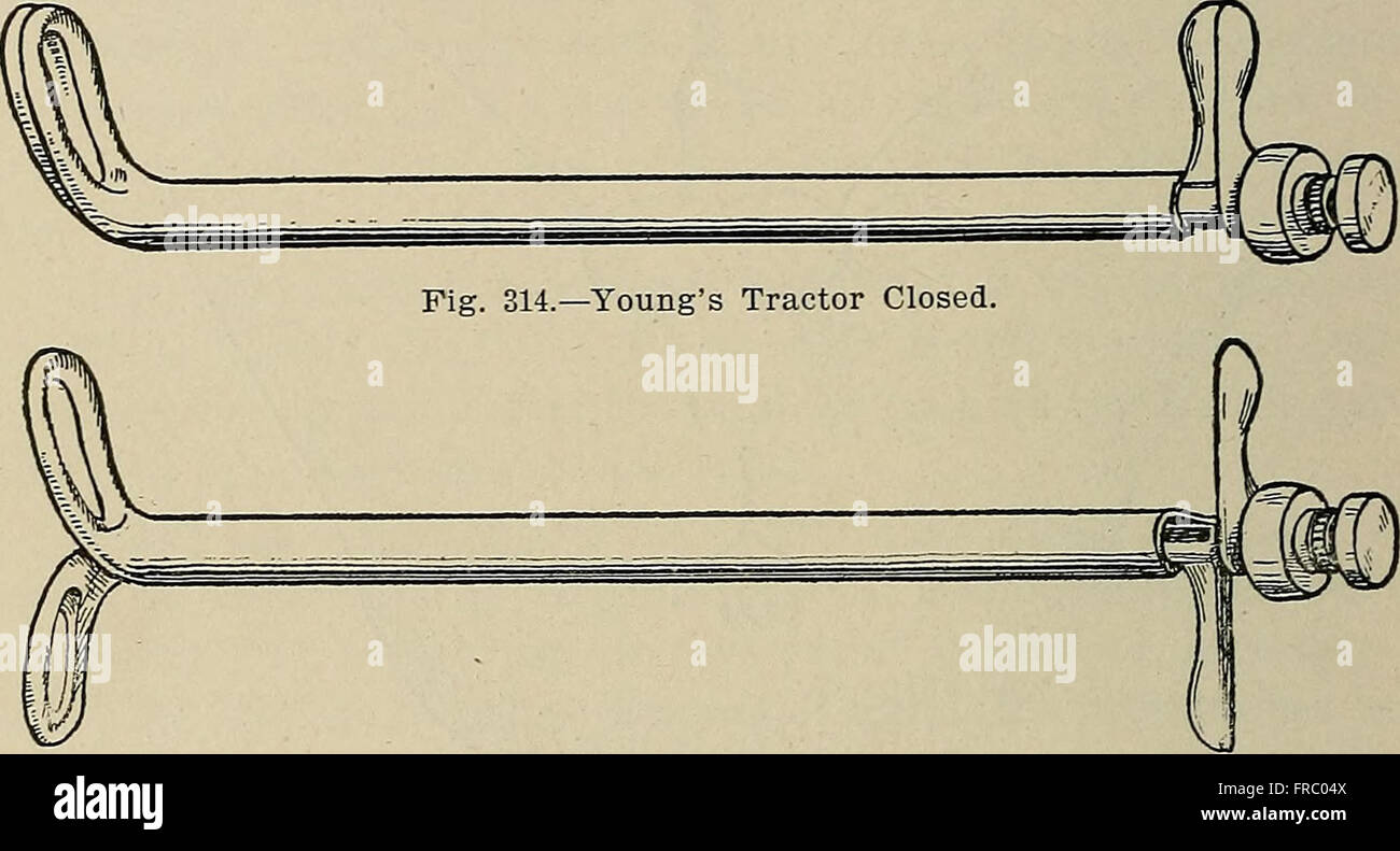 Operative surgery, for students and practitioners (1913 Stock Photo - Alamy