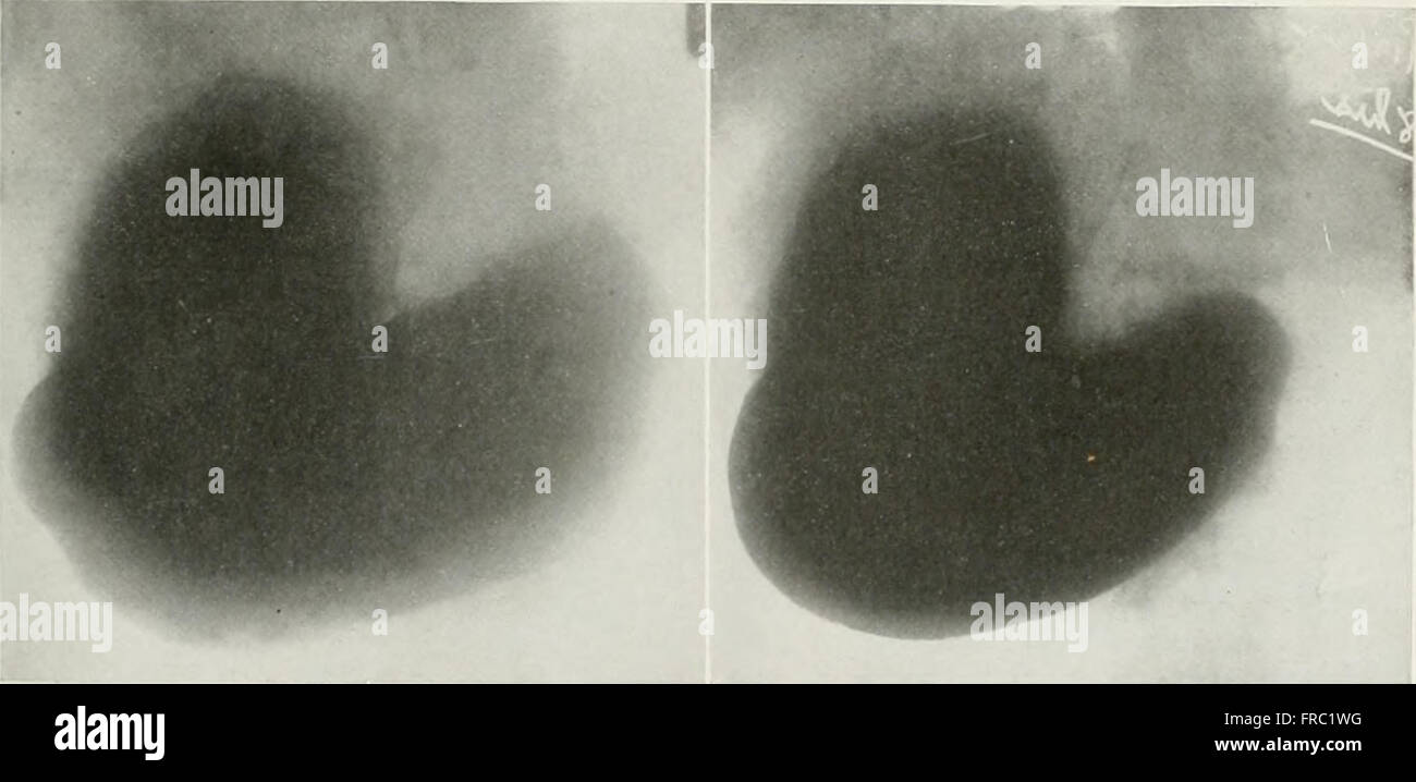 This 1906 journal covers developments in radiology, radium therapy, and ...
