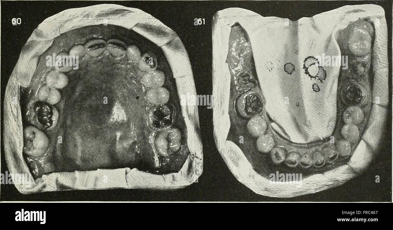 'Diseases of the Mouth' (1912) provides a detailed examination of ...