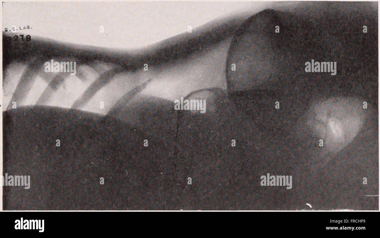 A 1919 medical journal focusing on the use of X-ray technology and ...