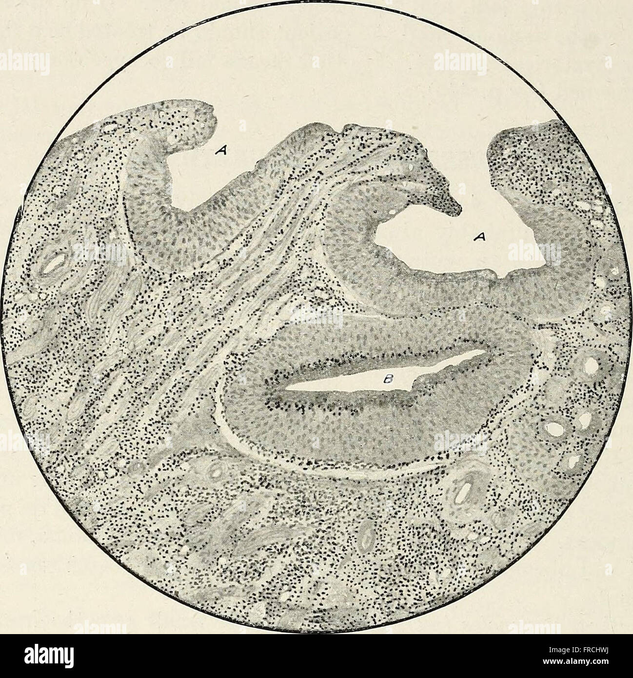 Gynaecology drawing hi-res stock photography and images - Alamy