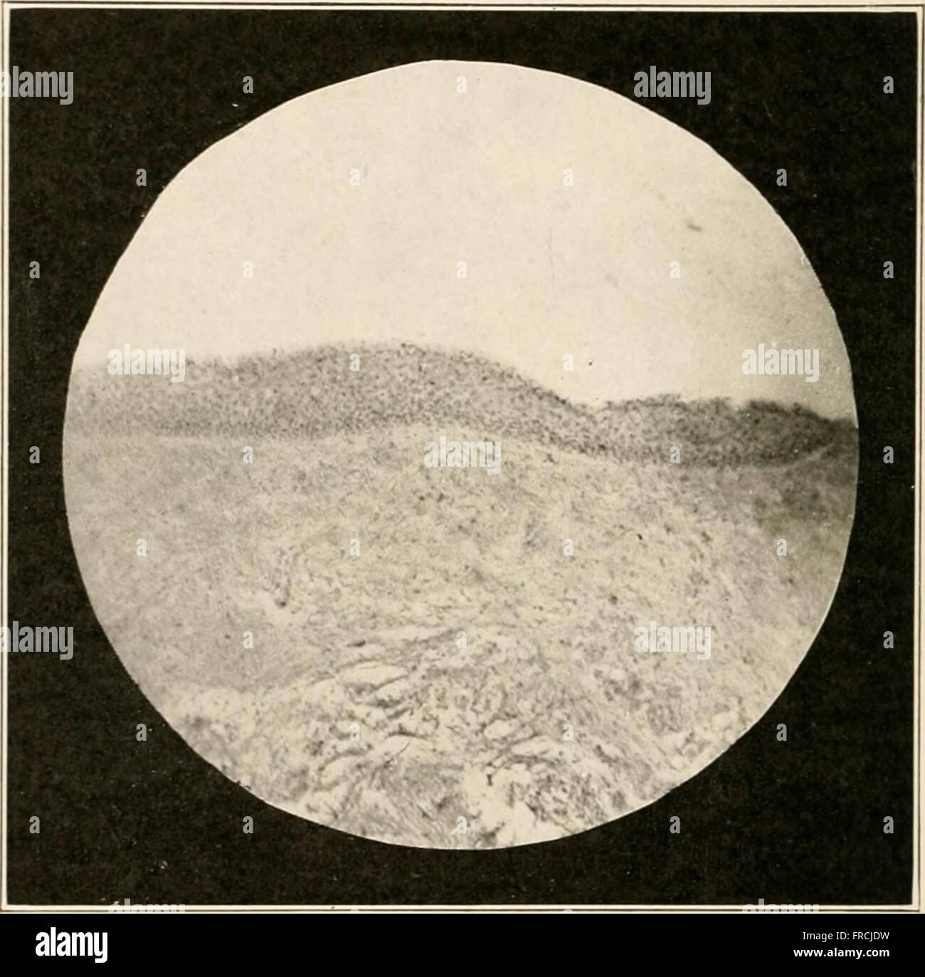 Interpretation of dental and maxillary roentgenograms (1918 Stock Photo ...