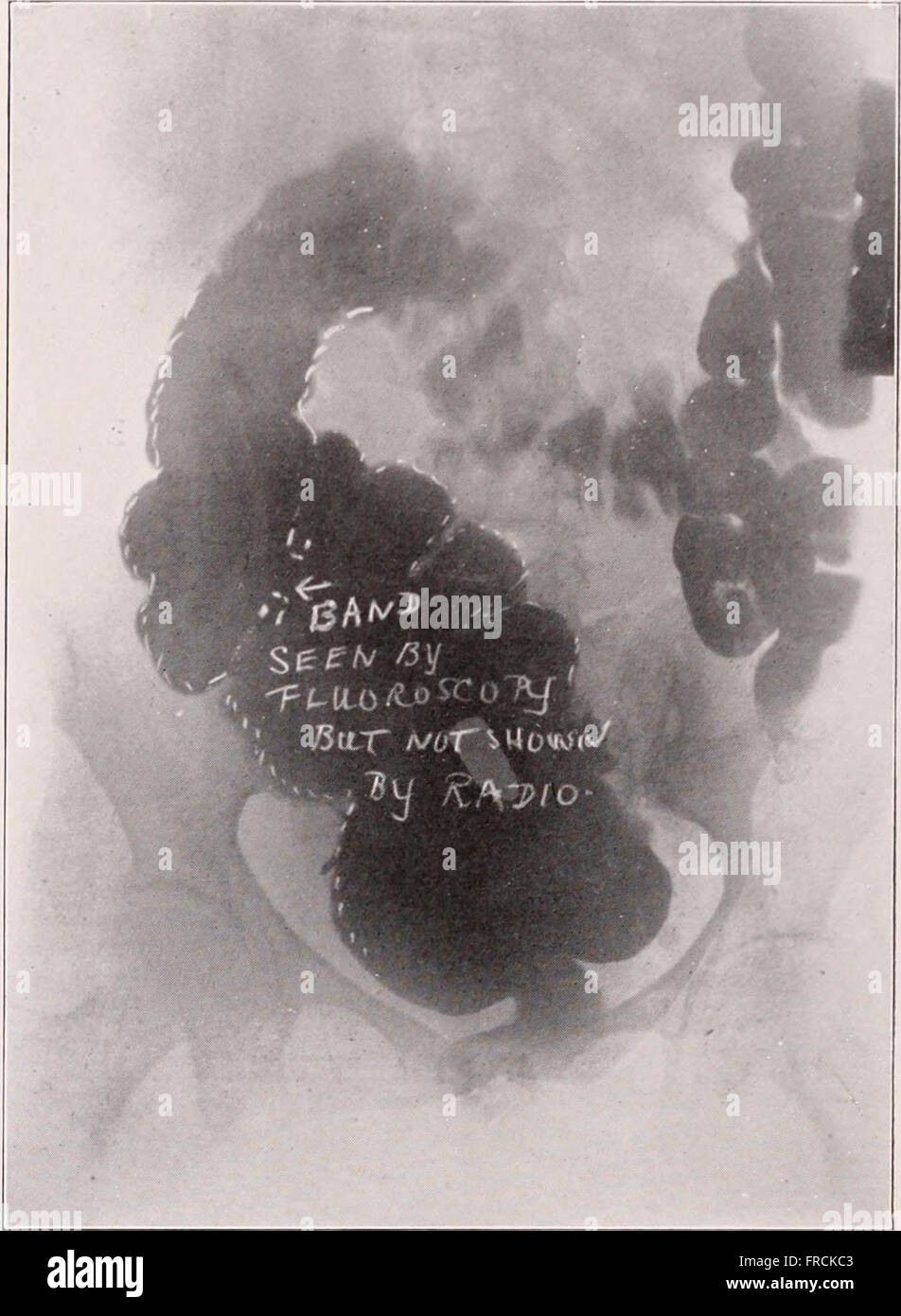 The 'Journal of Roentgenology' (1919) focuses on the advancements in X ...