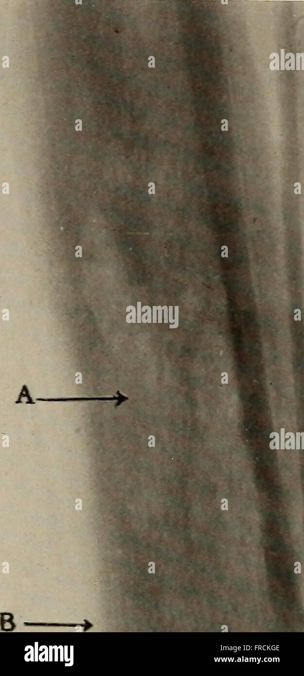 This 1910 work explores the relationship between living anatomy and ...