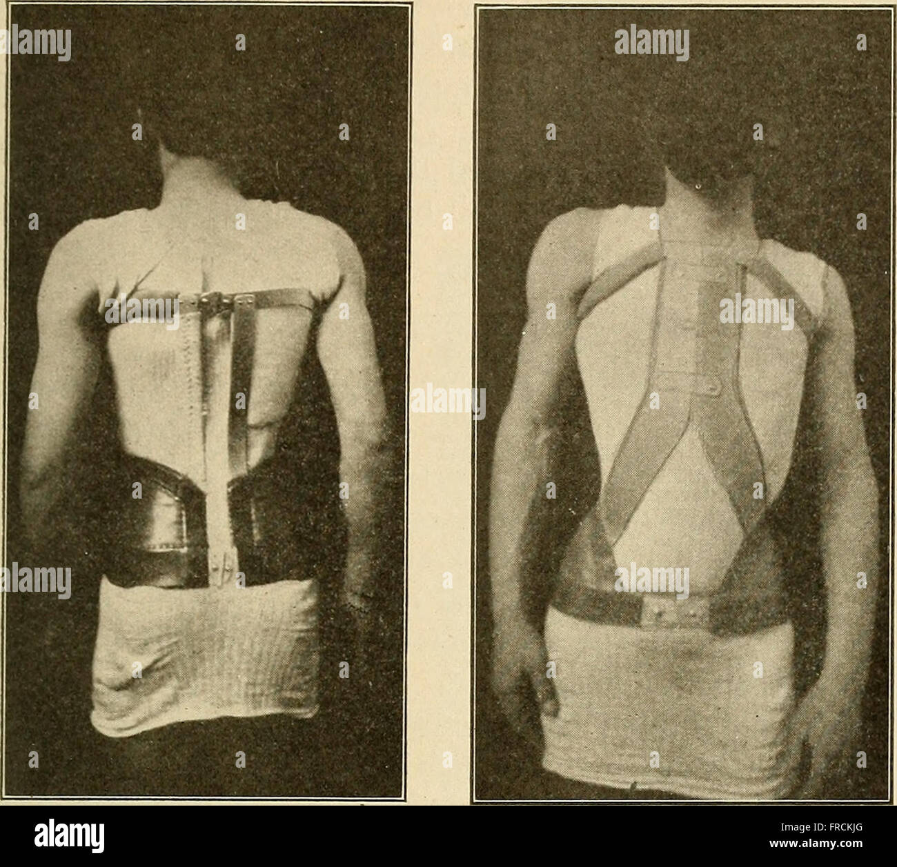 This 1916 work focuses on the causes, diagnosis, and treatment of ...