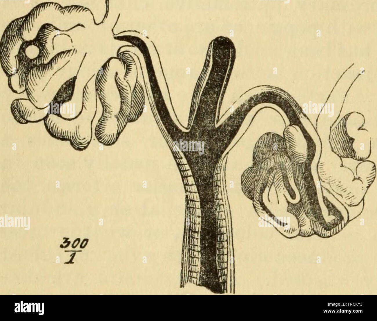 This 1875 manual offers comprehensive insights into pathological ...