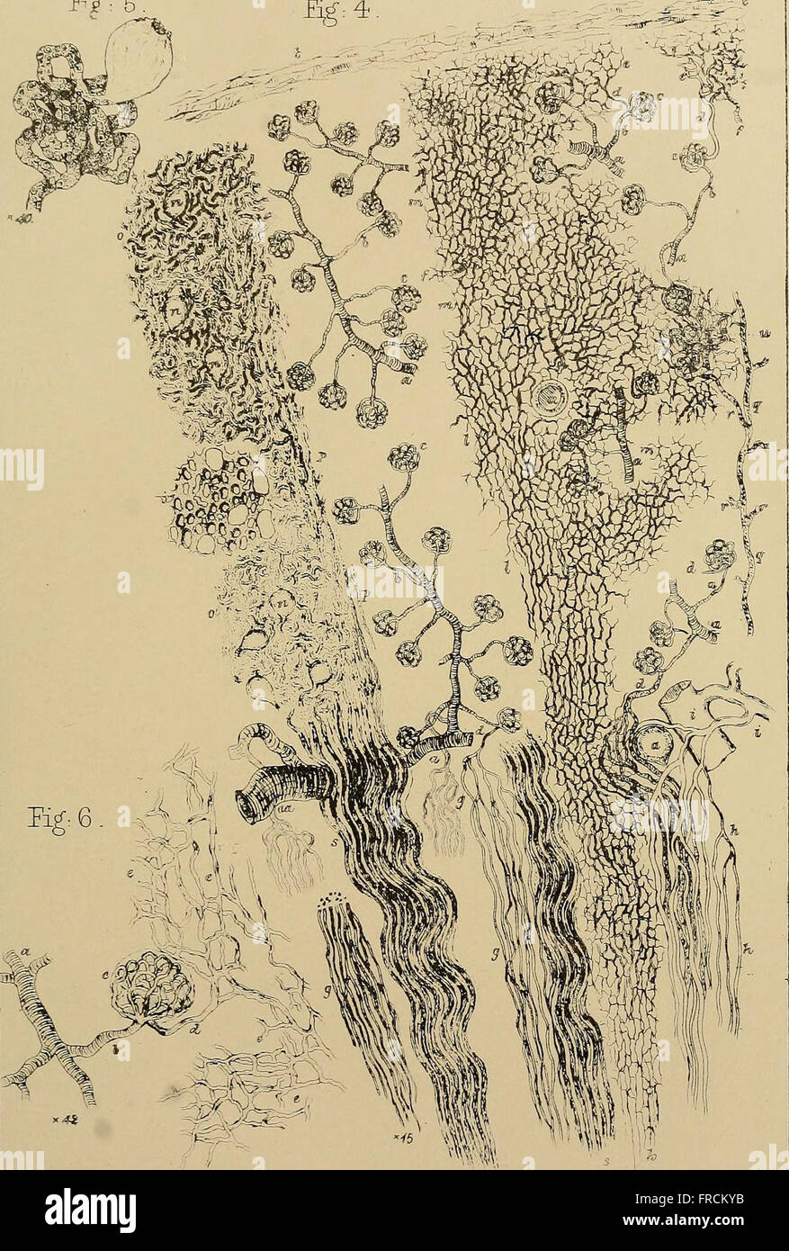 Kidney diseases, urinary deposits, and calculous disorders - their ...