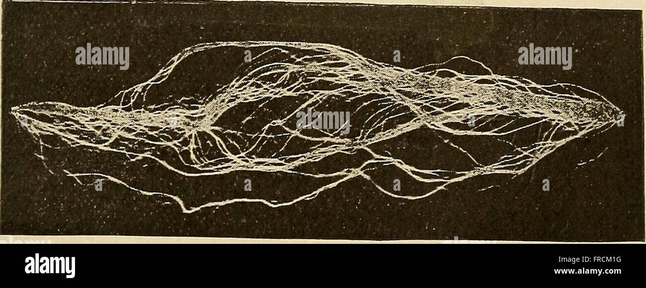 Manuel de Radioscopie et de Radiographie (1900) discusses the use of X ...