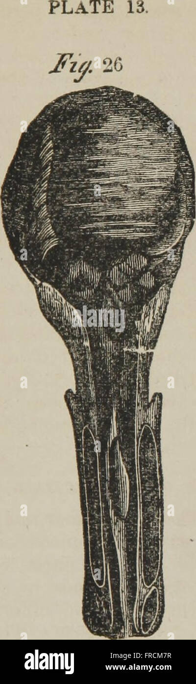 Female genital drawing hi-res stock photography and images - Alamy