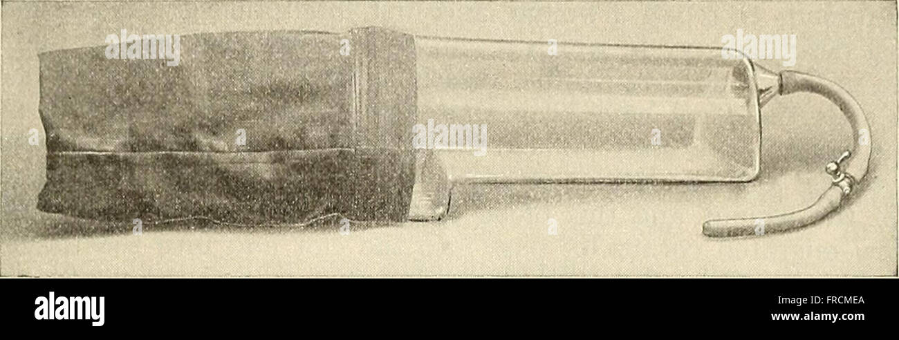 Modern surgery, general and operative (1914 Stock Photo - Alamy