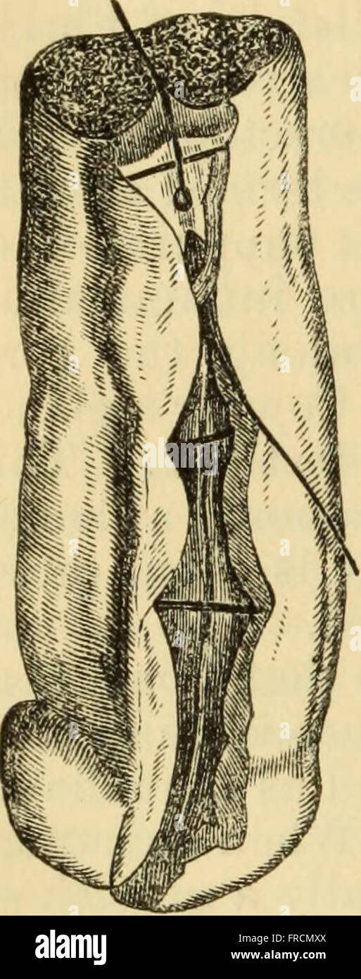 This 1875 manual provides an extensive overview of pathological anatomy ...
