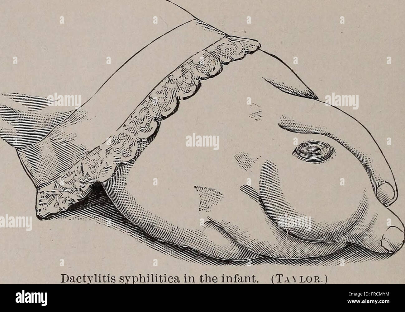 This 1899 medical text focuses on the role of symptoms in diagnosing ...