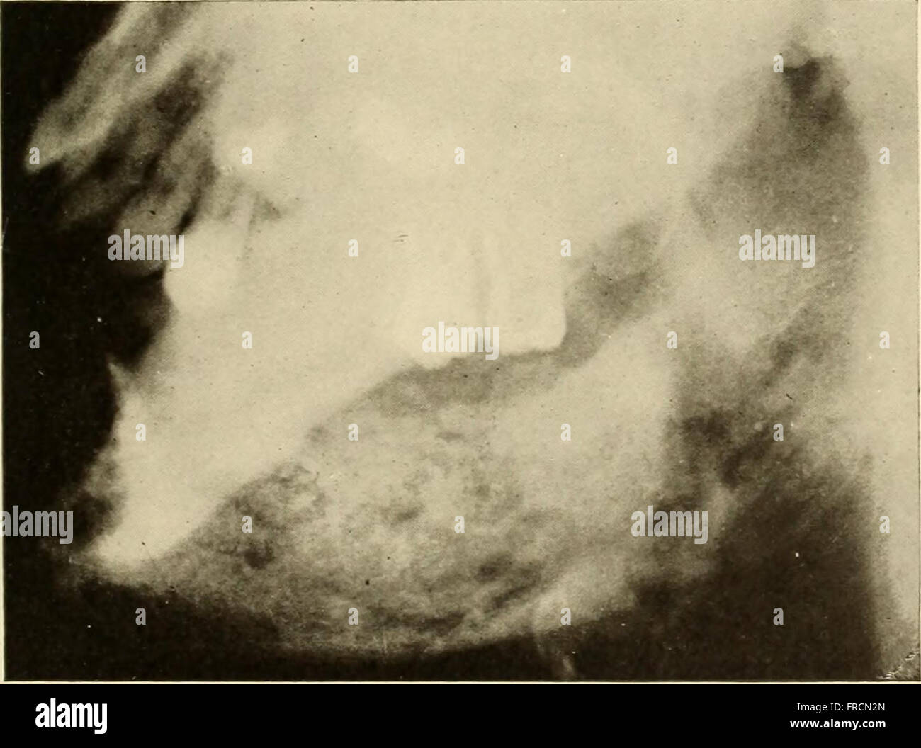 Kurt Hermann Thoma's 1917 book 'Oral Roentgenology' presents a detailed ...
