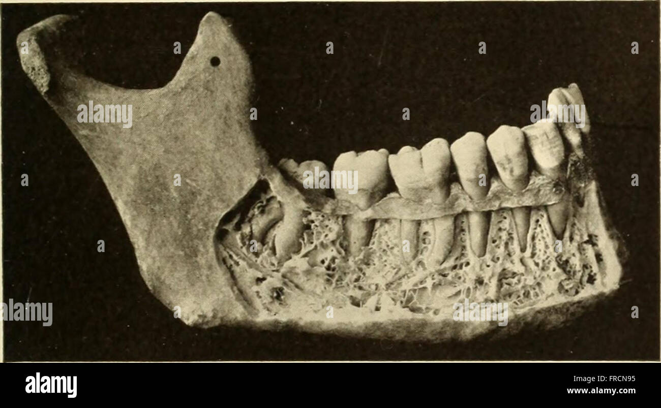 Oral Roentgenology - a Roentgen study of the anatomy and pathology of ...