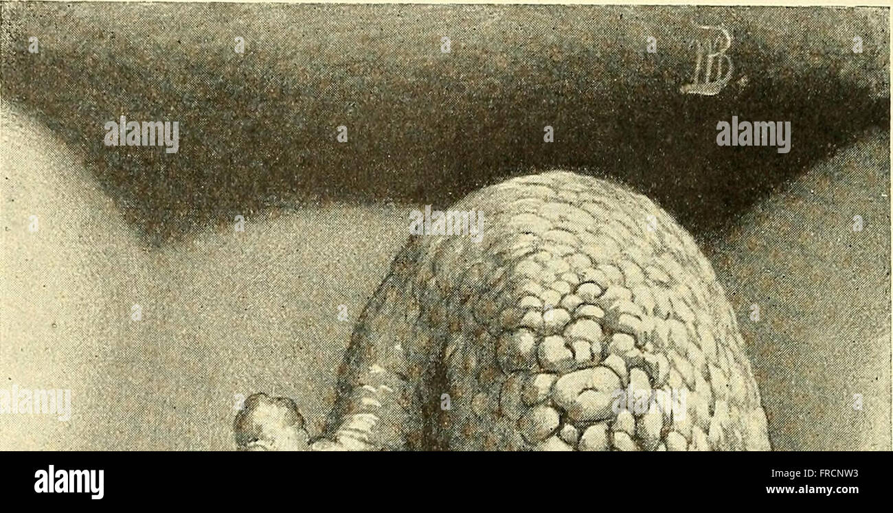 Operative Gynecology, published in 1906, focuses on surgical procedures ...