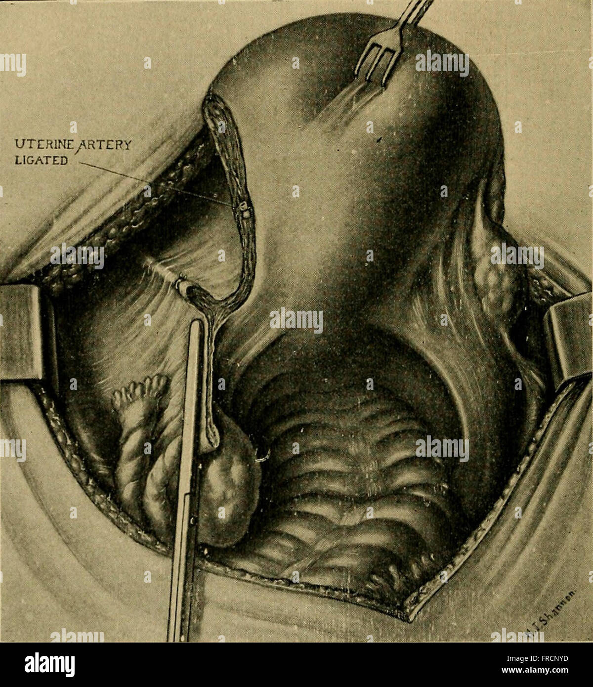 'Pelvic Inflammation in Women' (1921) discusses the causes, symptoms ...