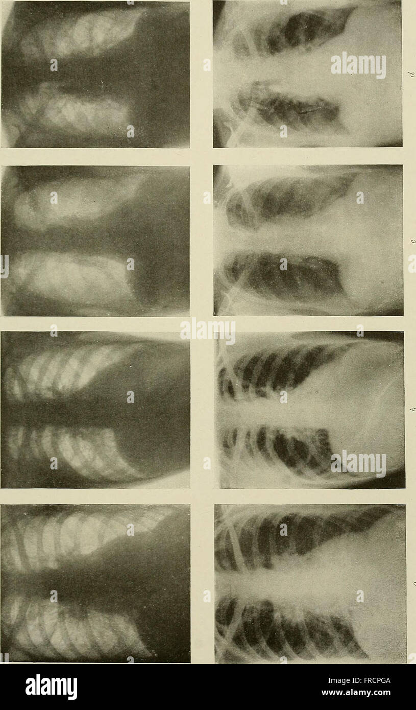 This 1919 work covers the principles and applications of radiography ...