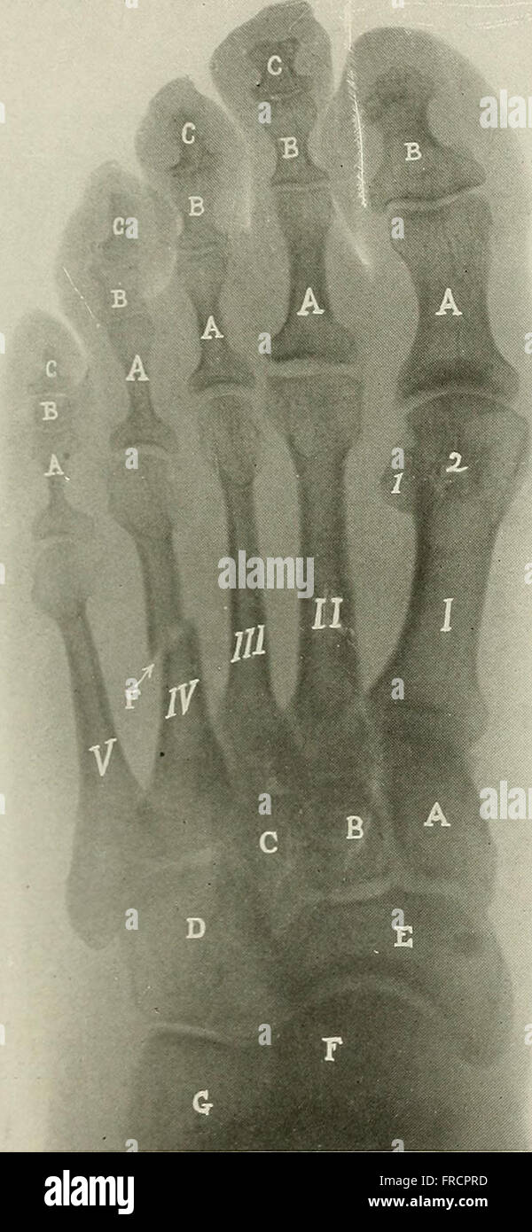This 1910 work explores the medical applications of Röntgen rays (X ...