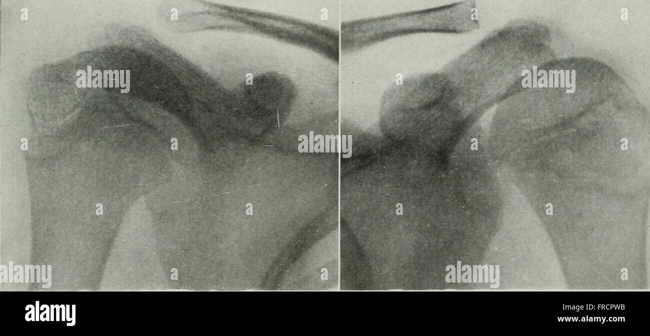 The American Journal of Roentgenology, Radium Therapy and Nuclear ...