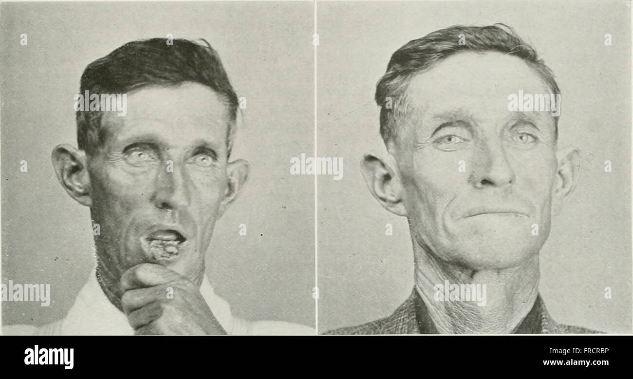 A 1906 journal covering the emerging fields of radiology, radium ...