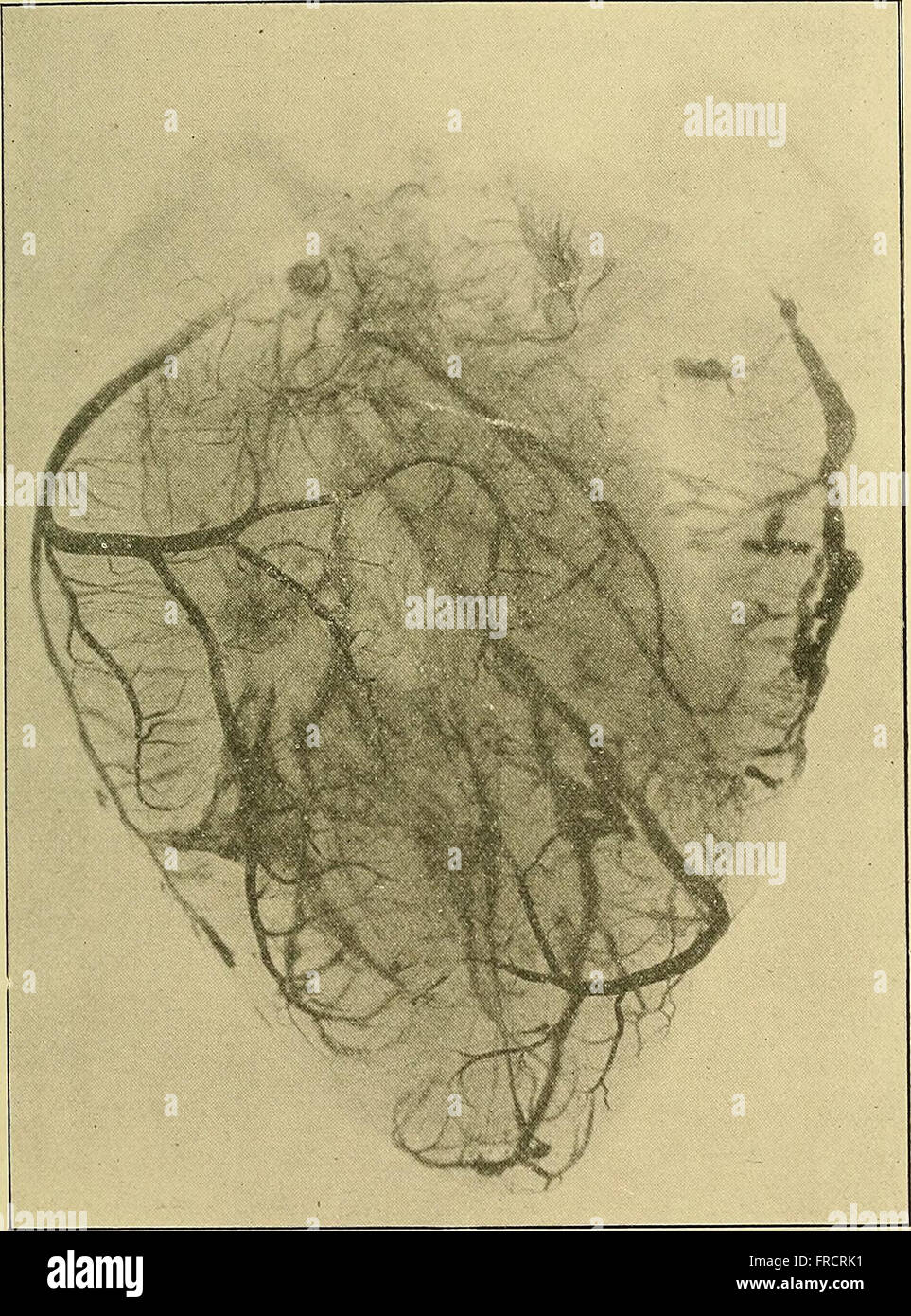 A manual of practical medical electricity - the RC3B6ntgen rays and ...