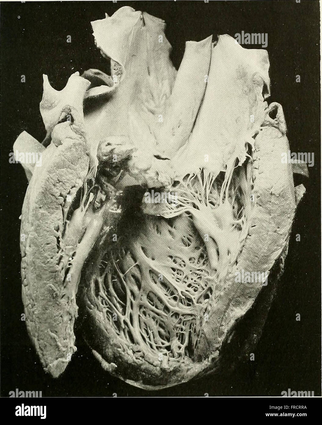 A 1911 medical study focusing on the pathology of the heart, exploring ...