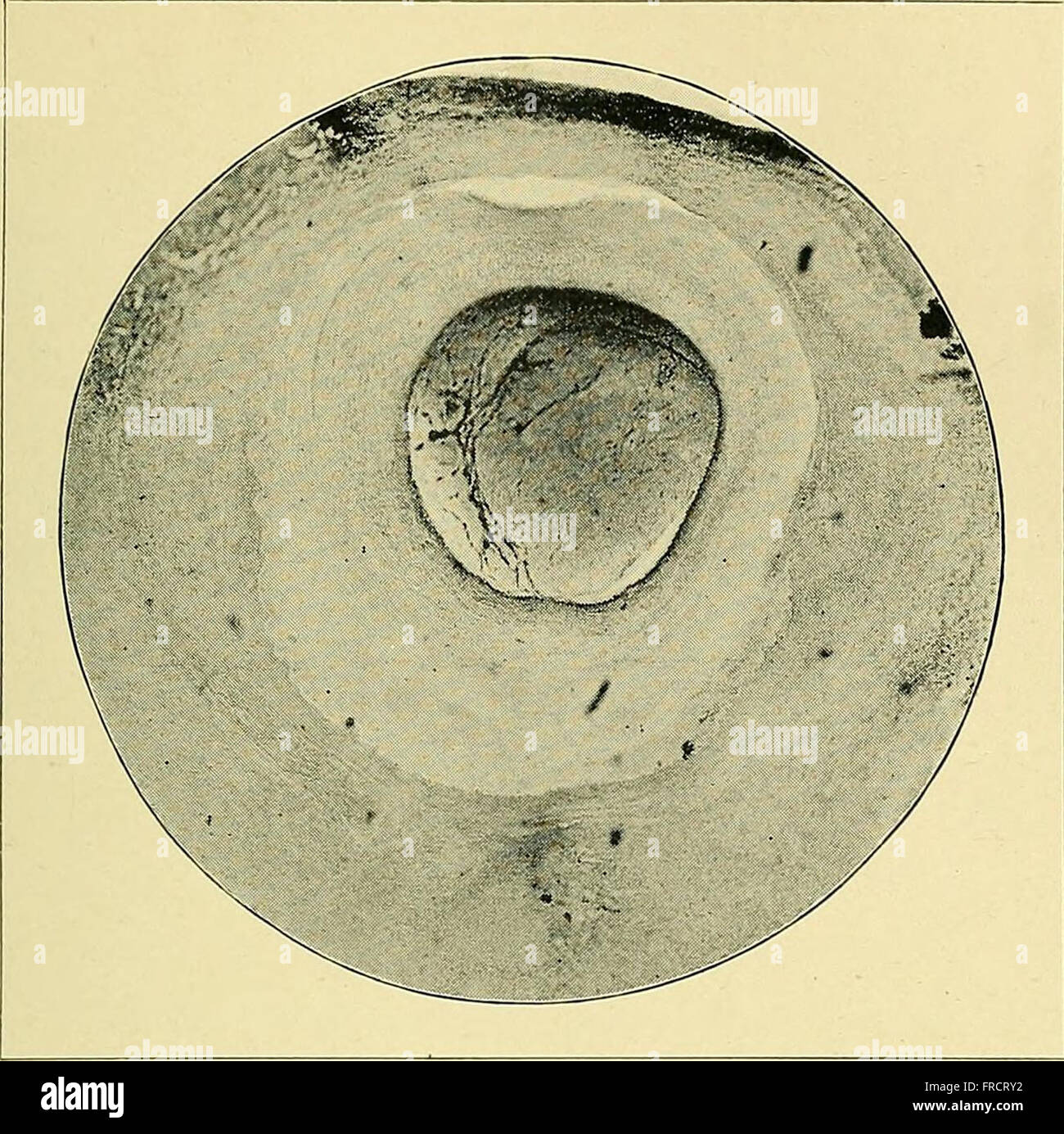 This 1895 text provides a thorough analysis of syphilis, covering its ...