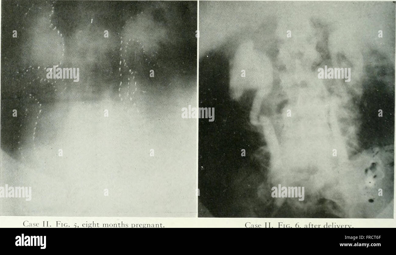 This 1906 journal explores advancements in X-ray technology, radium ...