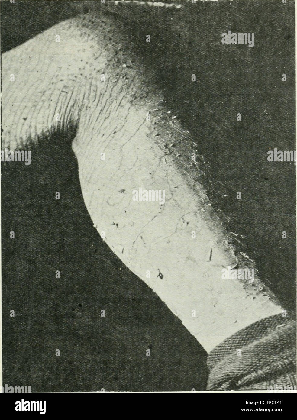 'The British Journal of Dermatology' (1888) focuses on advancements and ...