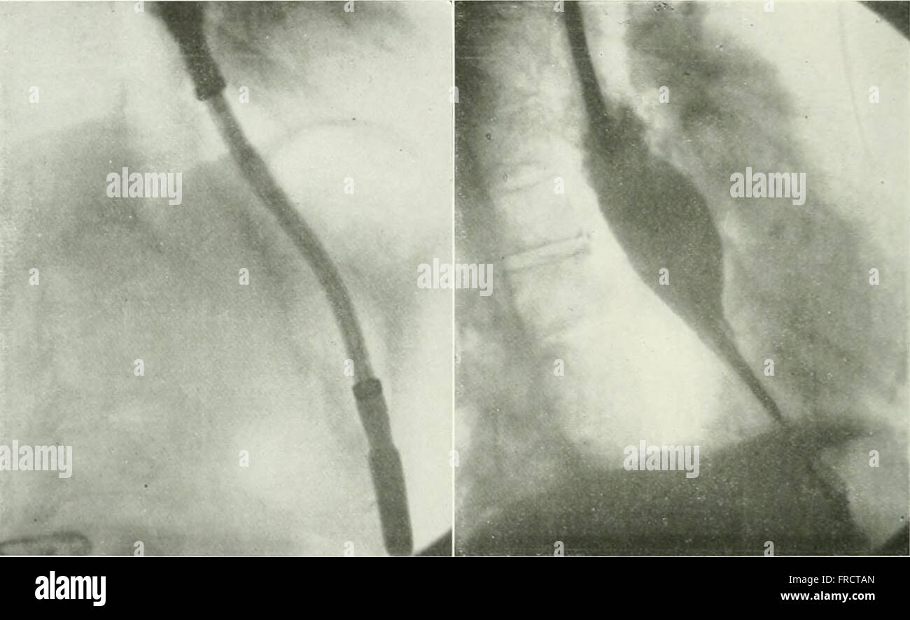 The American Journal of Roentgenology, Radium Therapy, and Nuclear ...