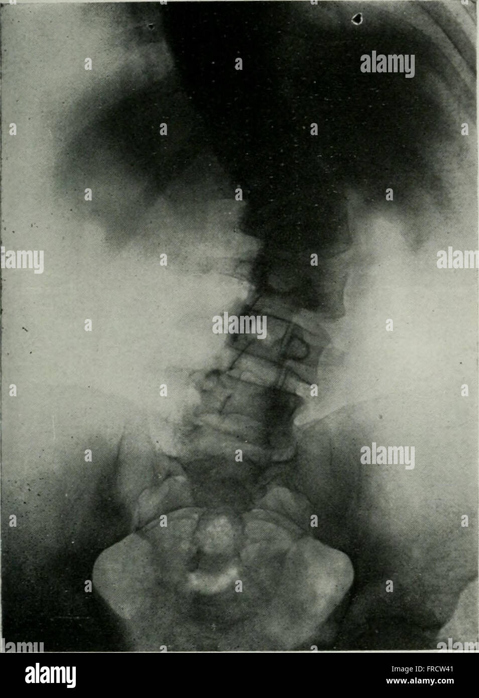 The 1906 edition of this journal covers the intersection of radiology ...