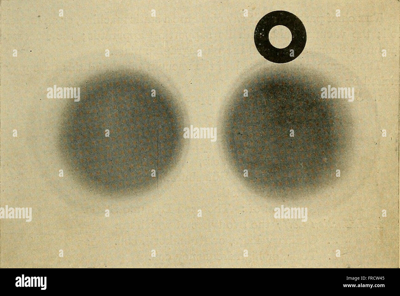 The Roentgen rays in medicine and surgery as an aid in diagnosis and as ...