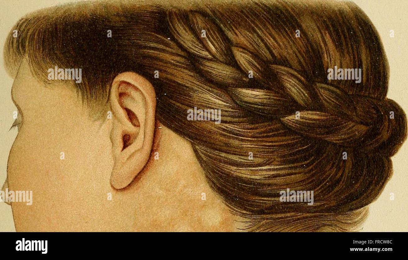 A manual of syphilis and the venereal diseases, (1900 Stock Photo - Alamy