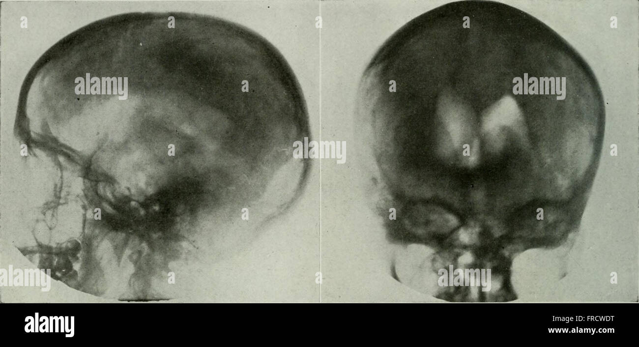 The American Journal of Roentgenology, Radium Therapy, and Nuclear ...