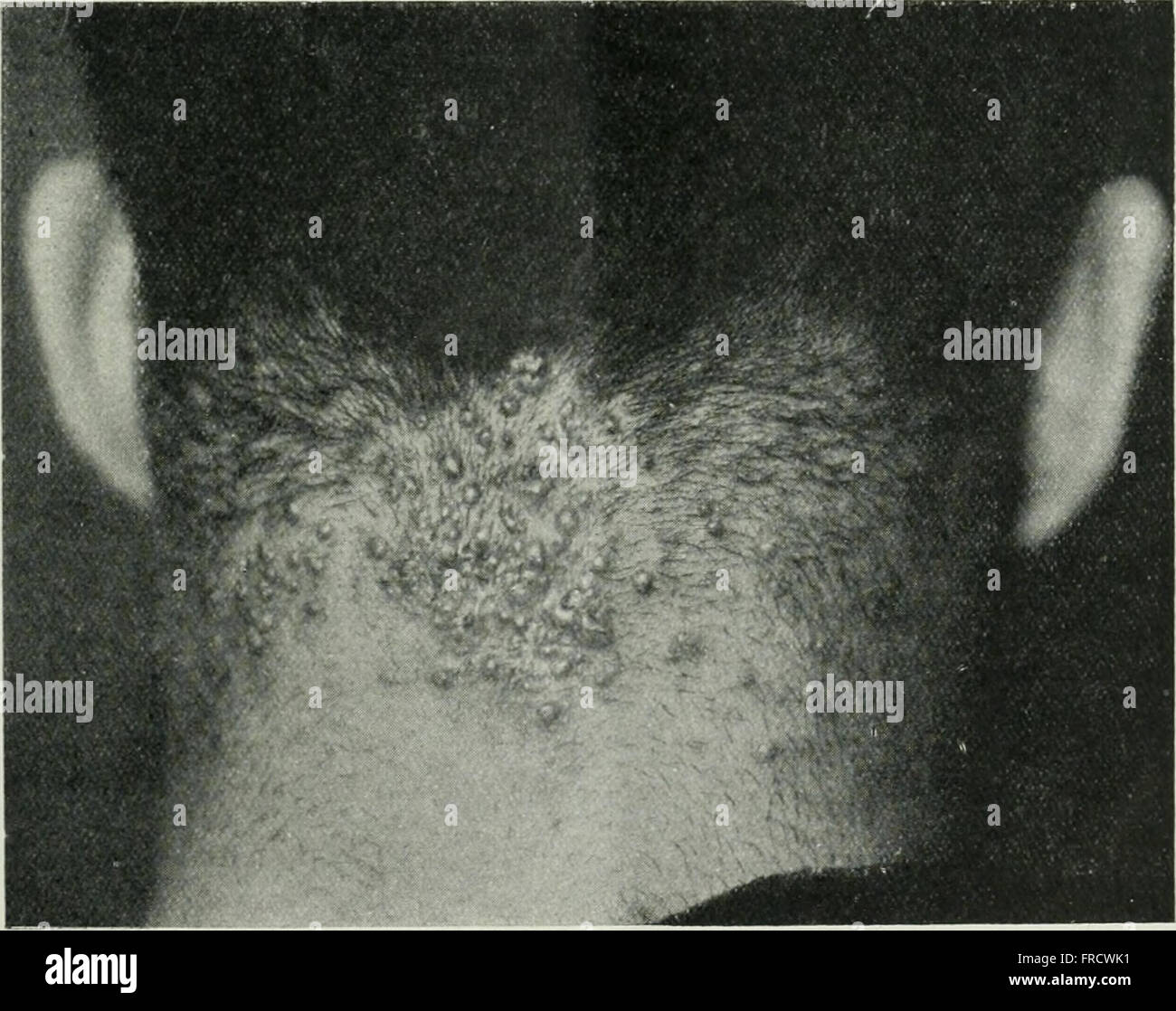 The British Journal of Dermatology (1888) provides a scholarly ...