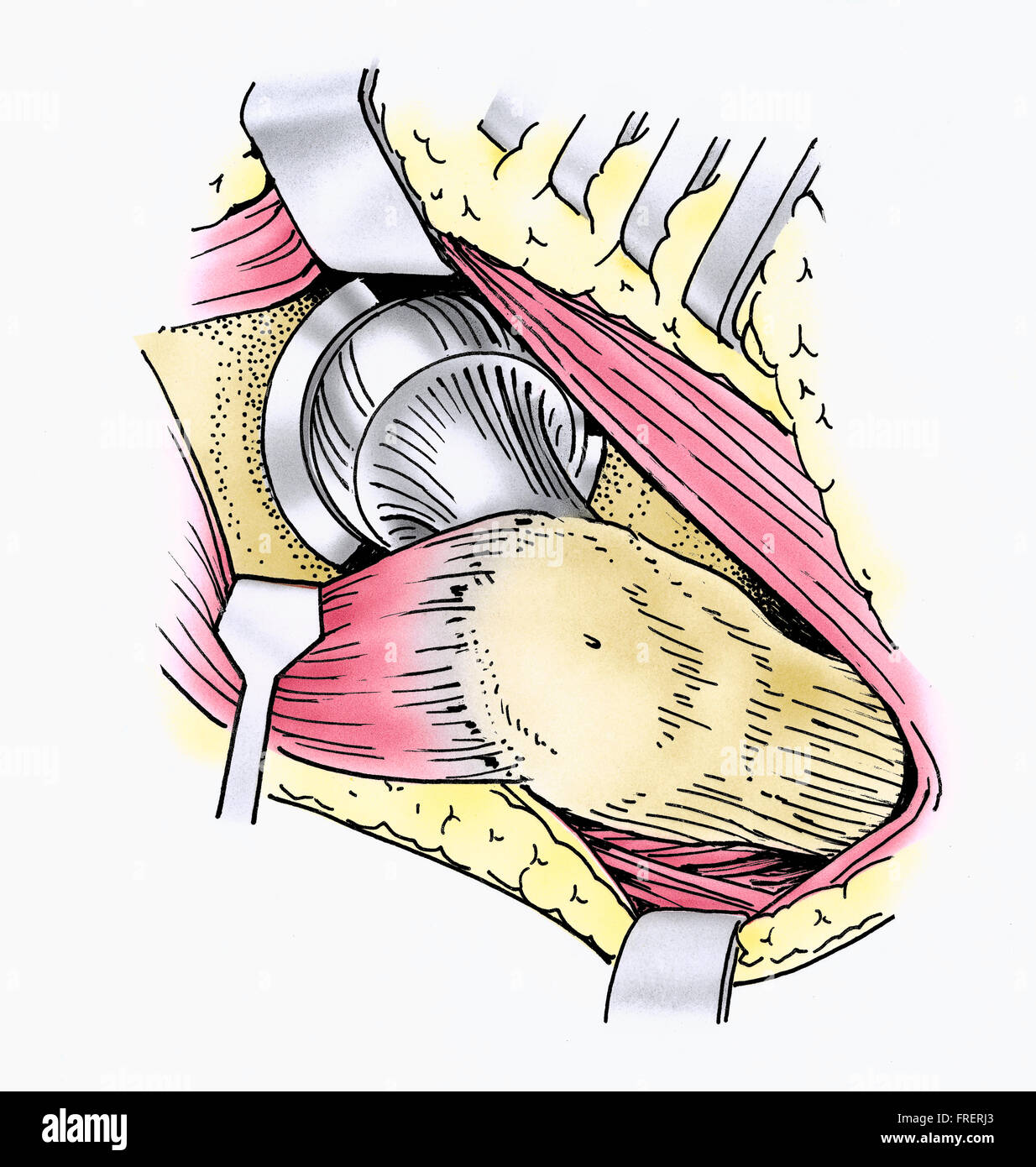 Pelvic socket Cut Out Stock Images & Pictures - Alamy